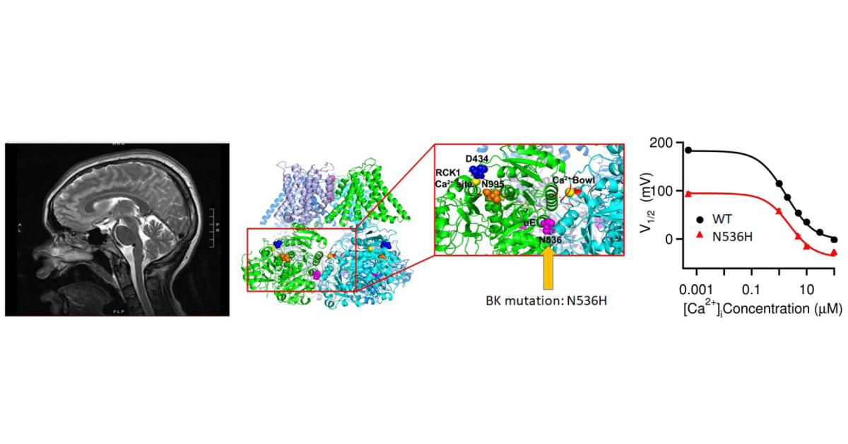 Yang Lab Collaboration Reveals New Discovery | Duke Department of ...